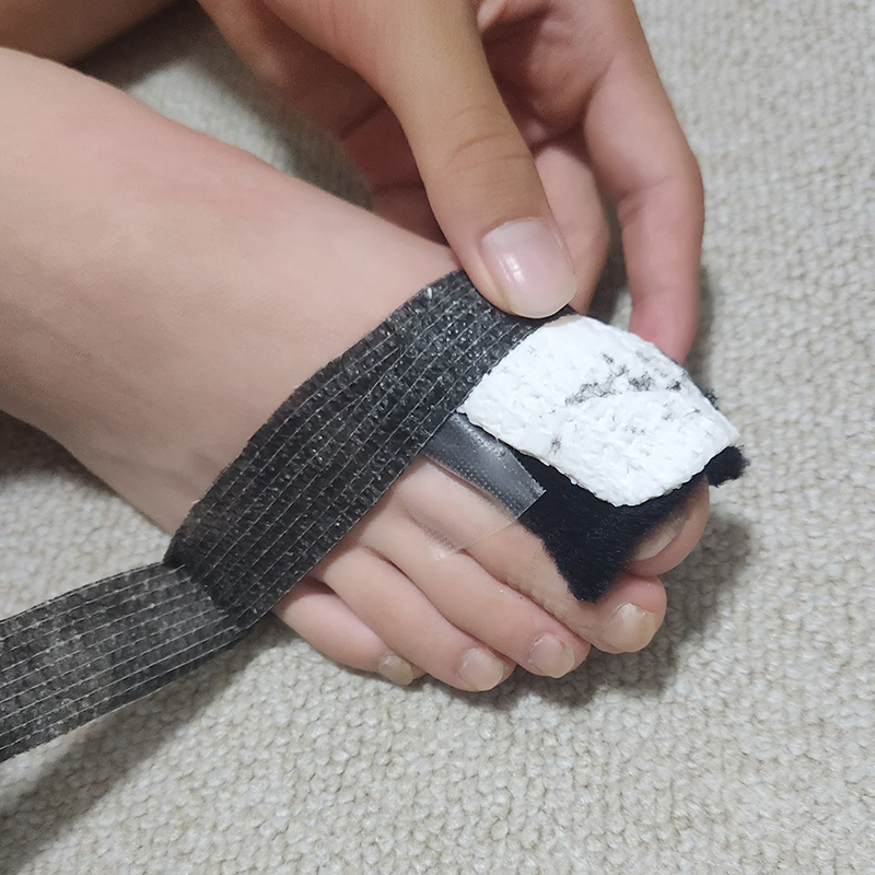 ジュニアユース 練習中「突き指」と思ったら「剥離骨折」だった話。よくそれで走ったなぁ・・・(^^;) | Ballond ( バロンド )